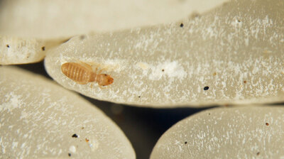 Microscopic Eyelash Bugs