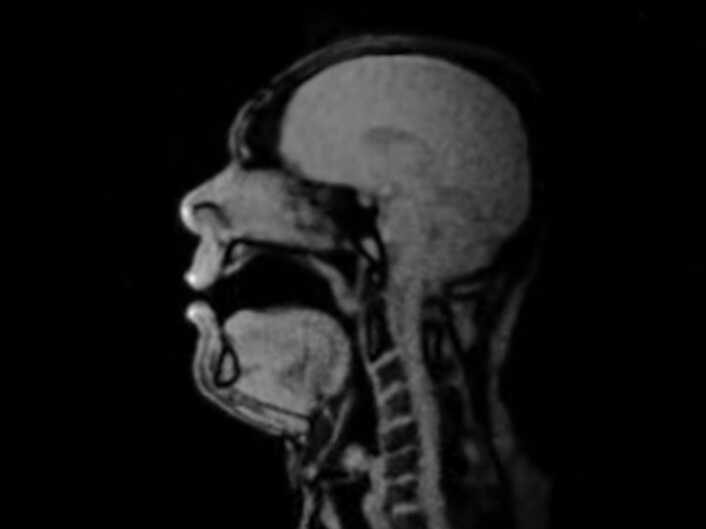 The Joy Of Seeing Your Gooey Innards : 13.7: Cosmos And Culture : NPR