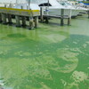 Poisonous Algae Blooms Threaten People, Ecosystems Across U.S. : NPR