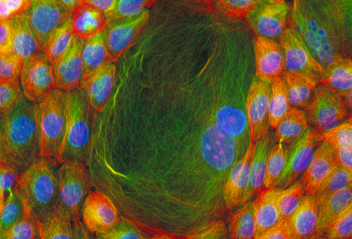 A Map To Help Cancer Doctors Find Their Way : Shots - Health News : NPR