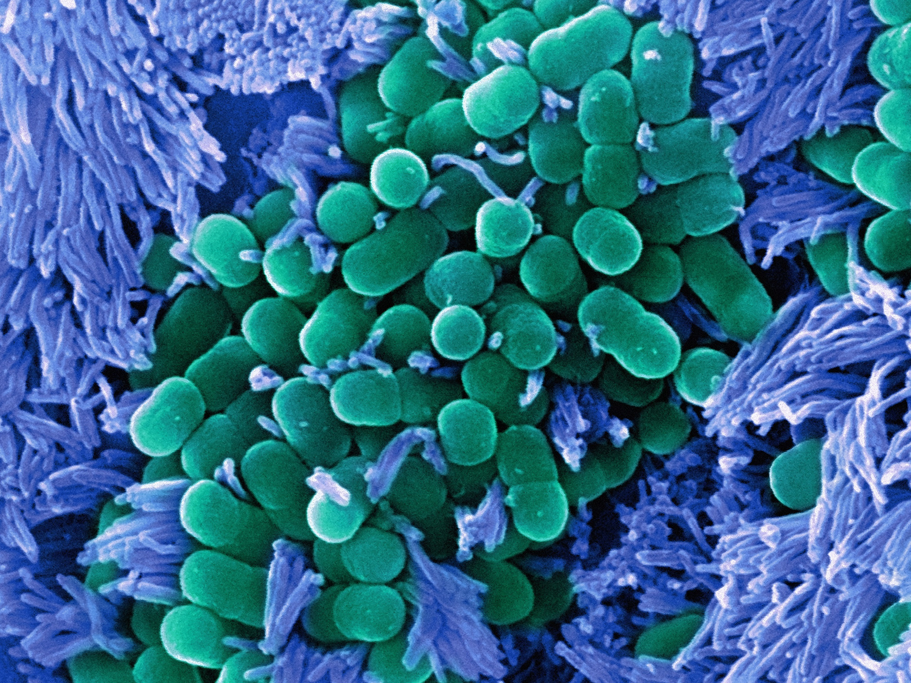 How The Microbes Inside Us Went From Enemies To Purported Superhealers ...