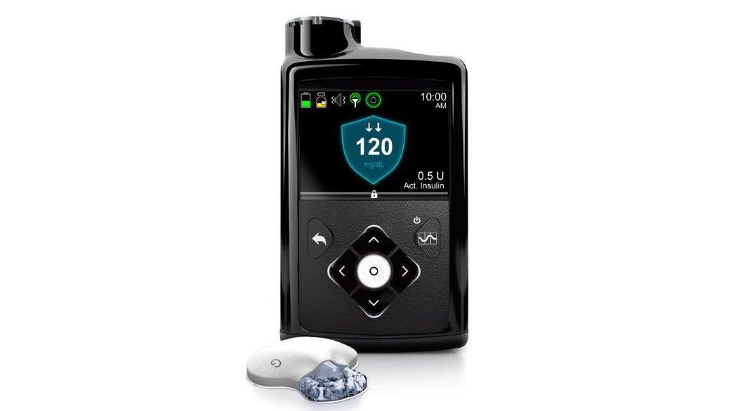 For People With Type 1 Diabetes, An 'Artificial Pancreas' Is Almost ...