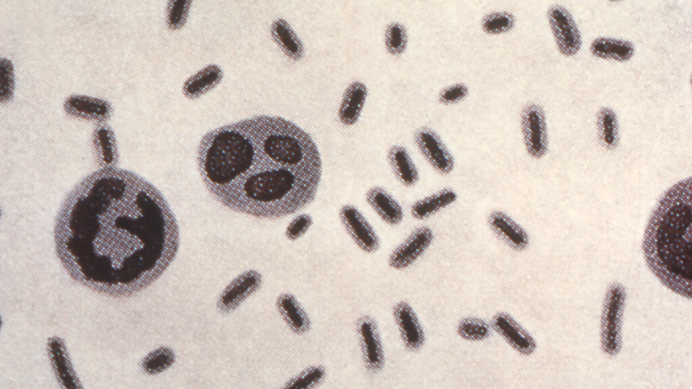 Superbug That Killed A Nevada Woman Resisted 26 Antibiotics : Goats and ...
