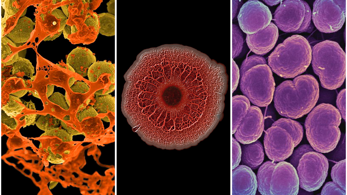 WHO Names The 12 Superbugs Posing The Greatest Threat To Human Health ...