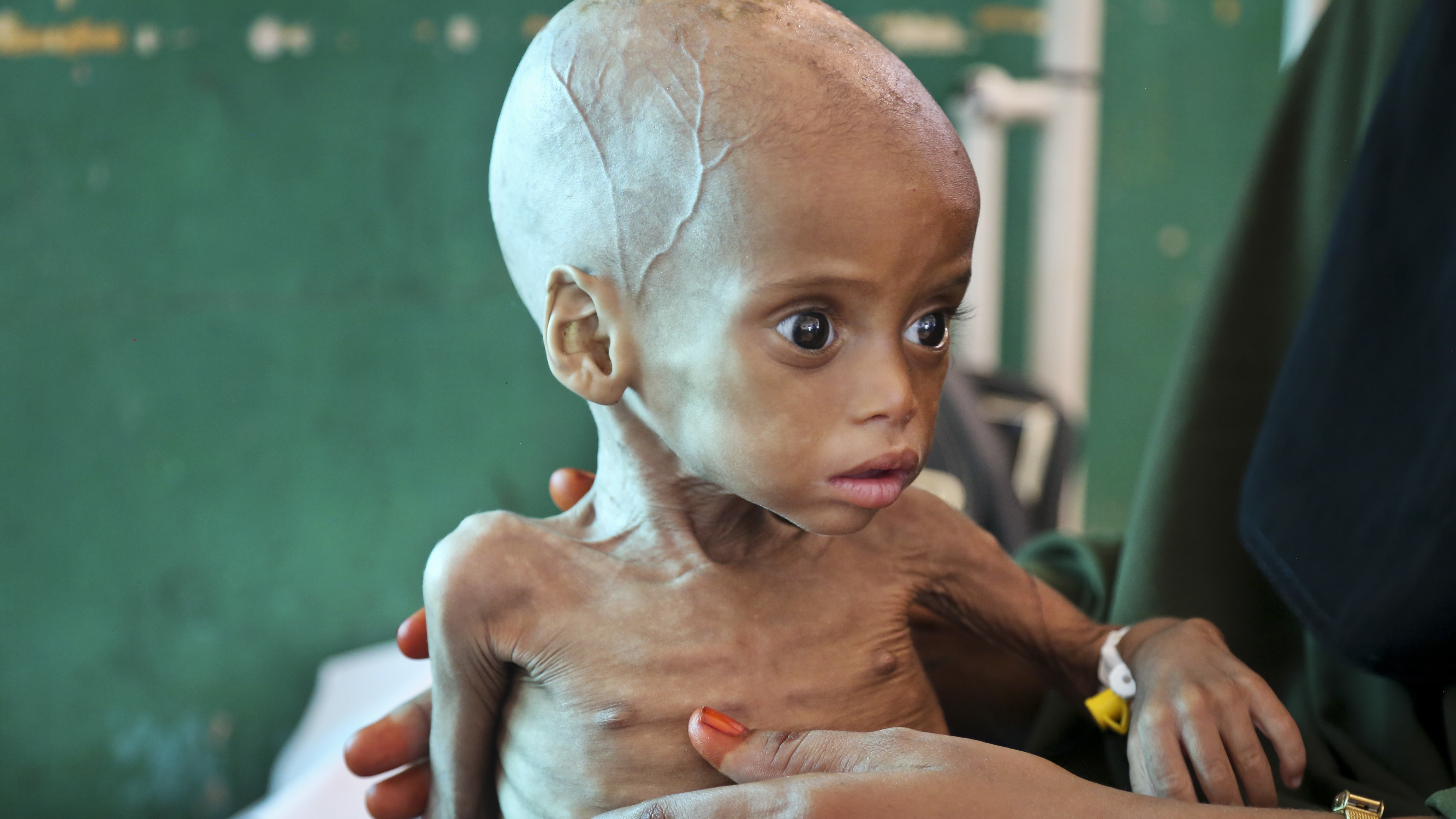 U.N. Official: 'World Faces Largest Humanitarian Crisis Since 1945 ...