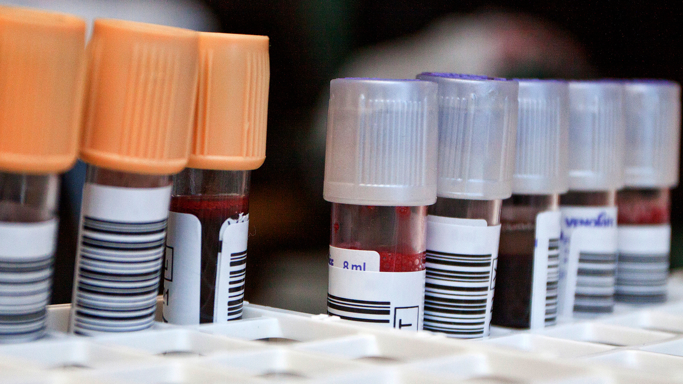 Common Blood Tests Can Help Predict Disease Risk : Shots - Health News ...
