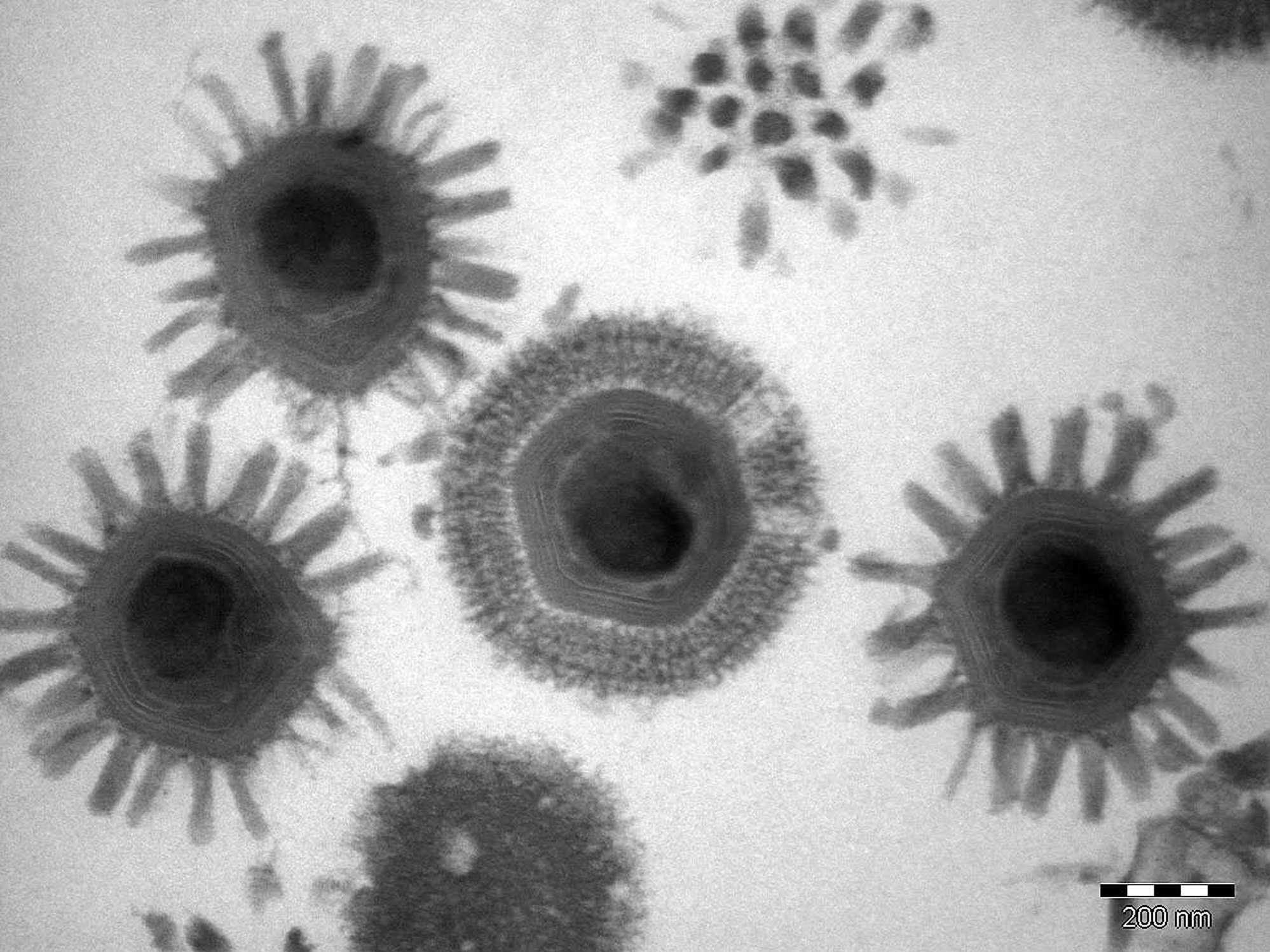 In Giant Virus Genes, Hints About Their Mysterious Origin - capradio.org