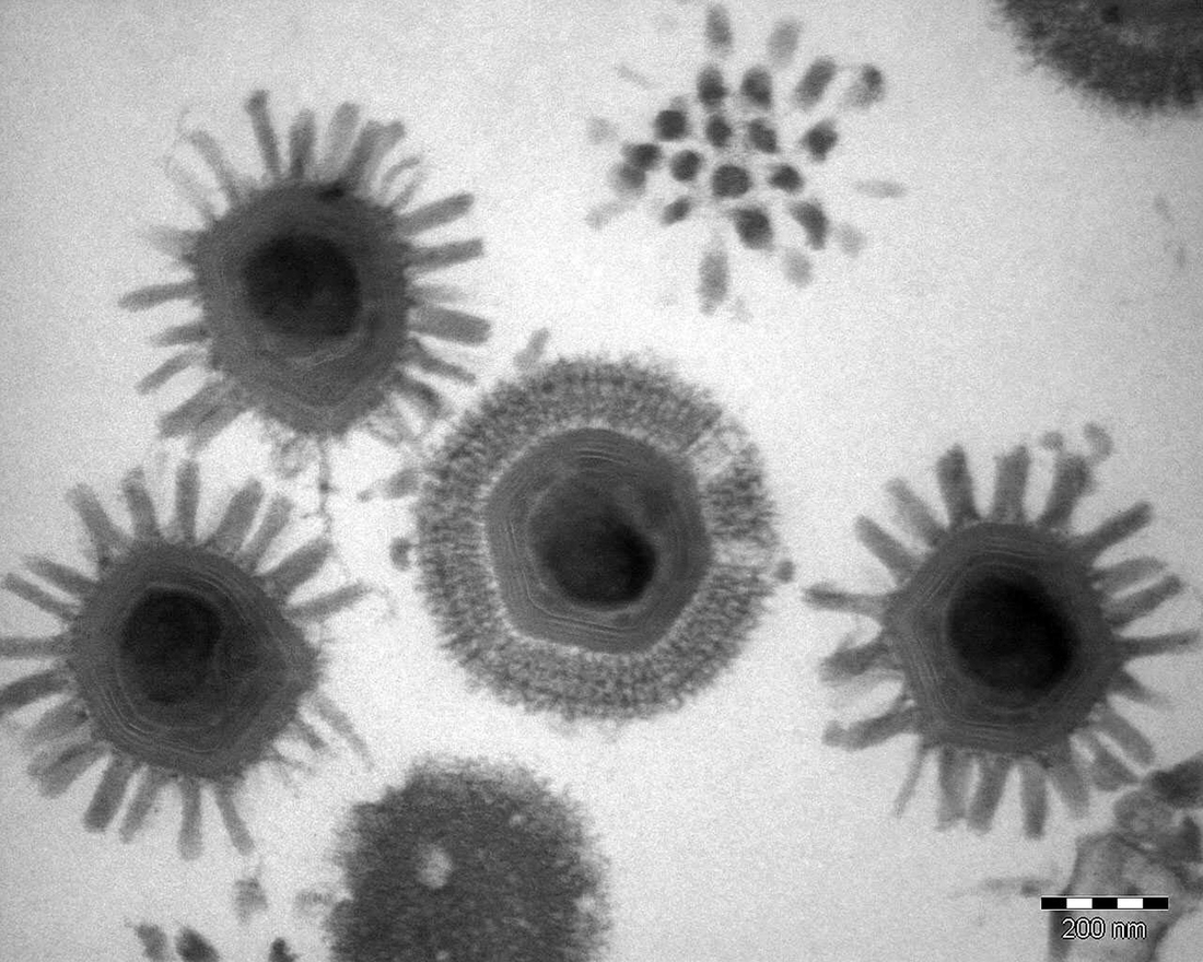 Giant Virus Origins Become A Little Clearer : Shots - Health News : NPR