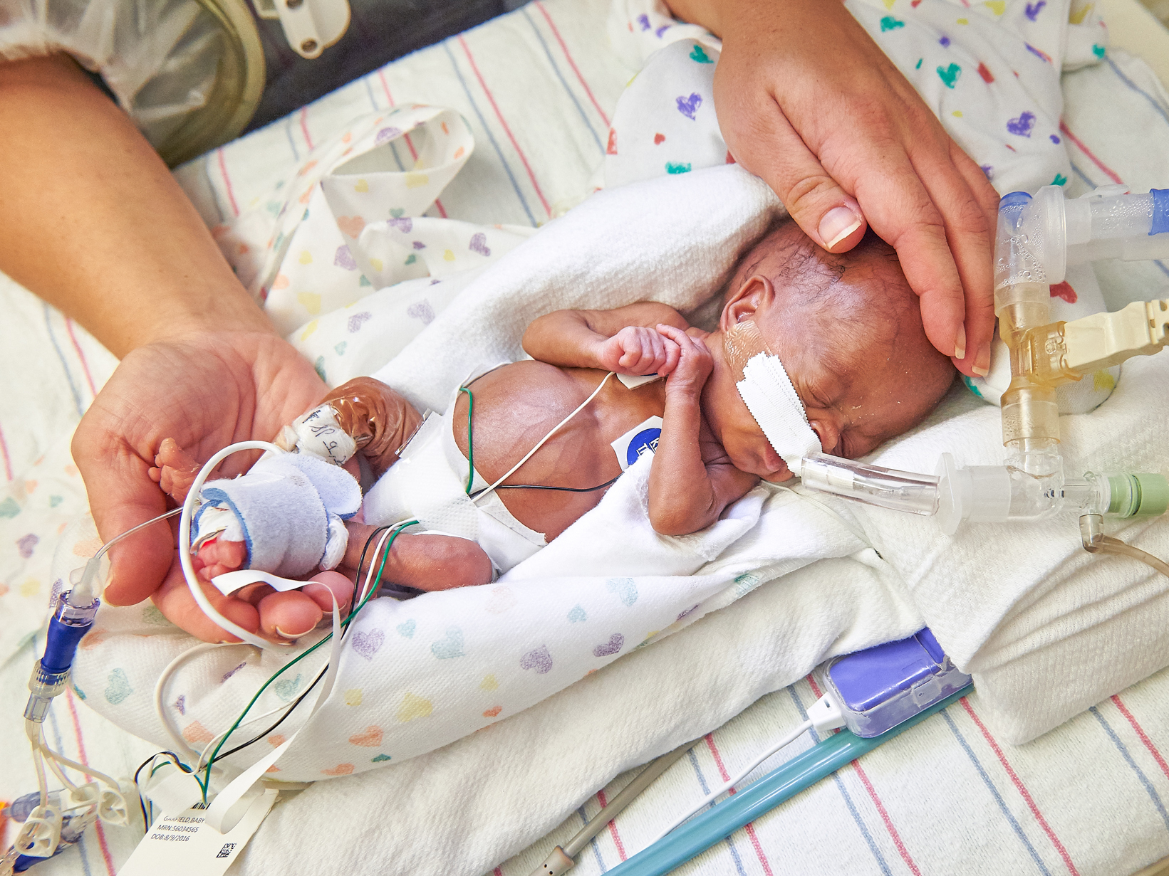 Scientists Create Artificial Womb That Could Help Prematurely Born ...