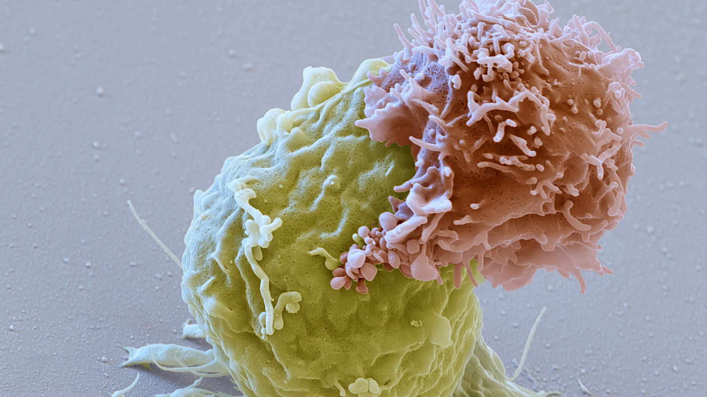 FDA Advisers Endorse Genetically Engineered Immunotherapy For Cancer ...