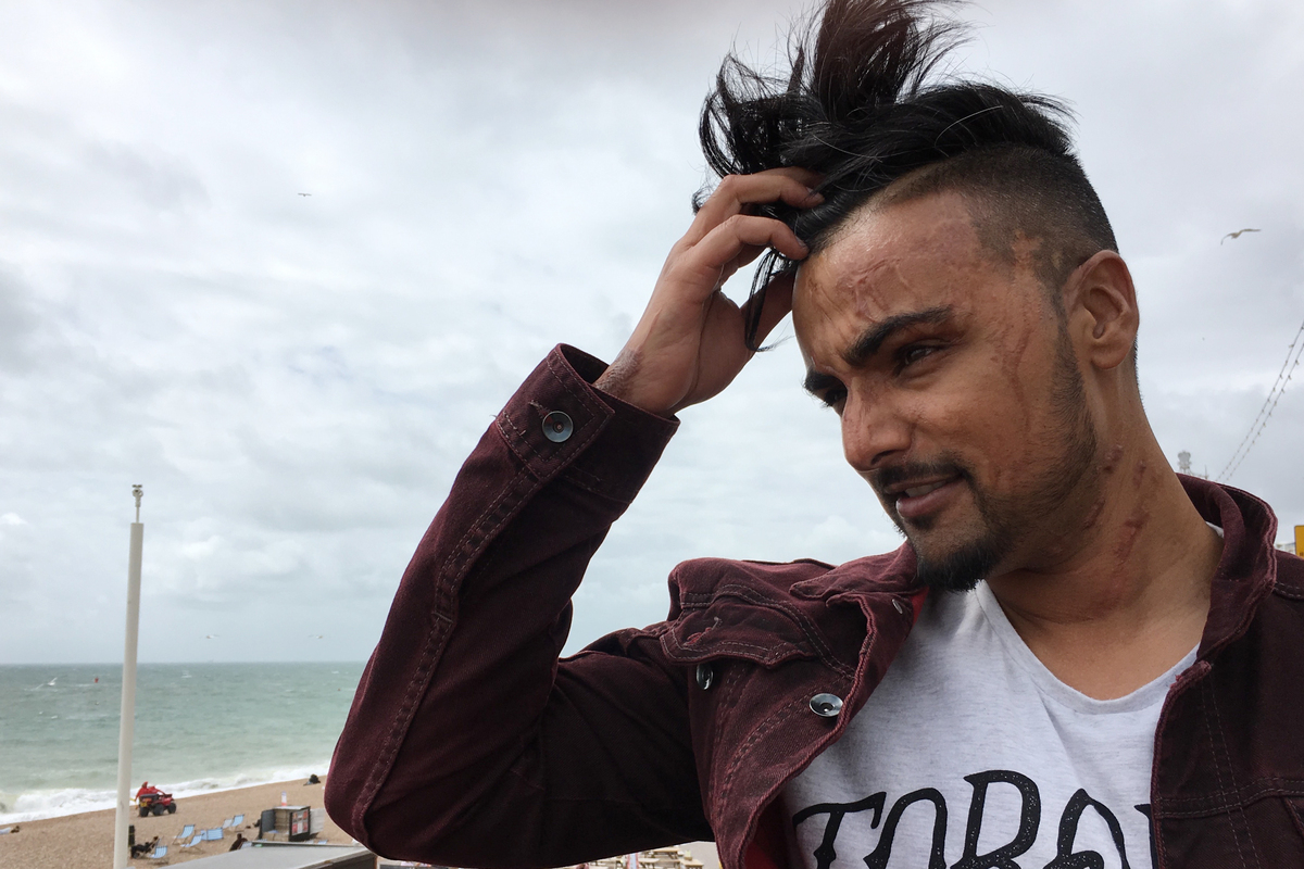 Acid Attacks On The Rise In The U.K. : Parallels : NPR