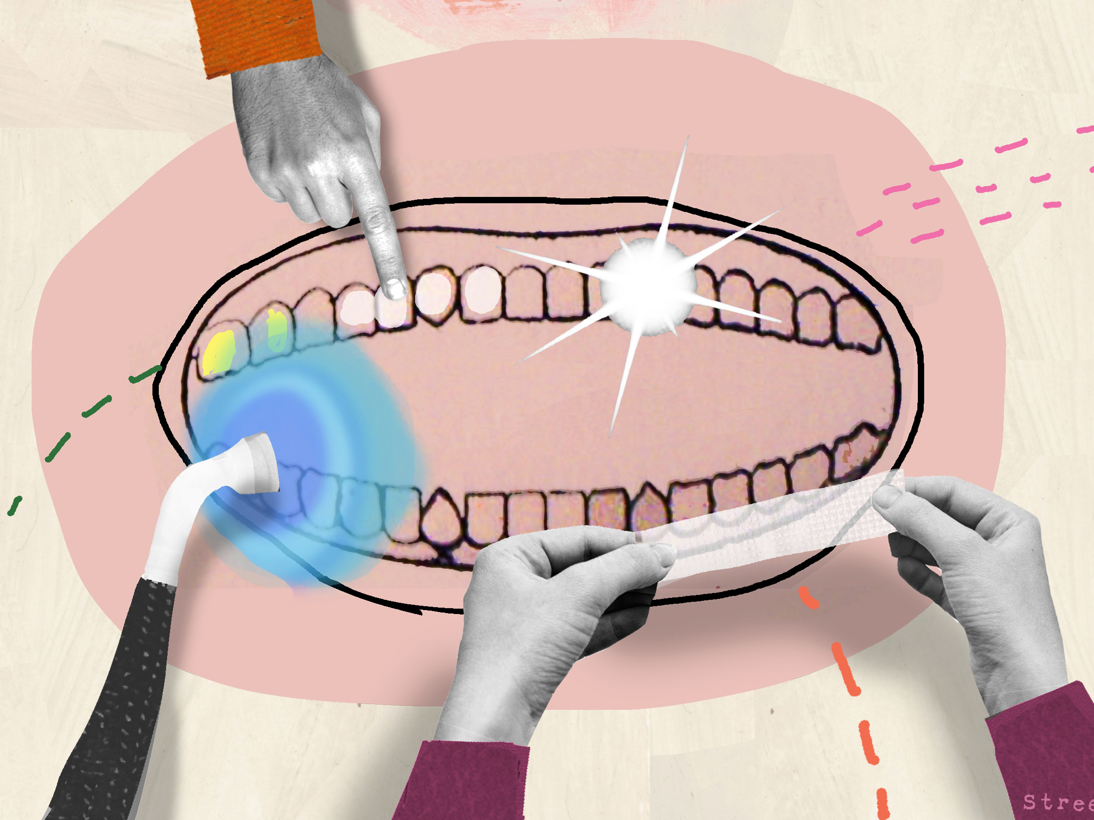 Navigating The 'Aisle Of Confusion' To Whiten Your Teeth | NCPR News