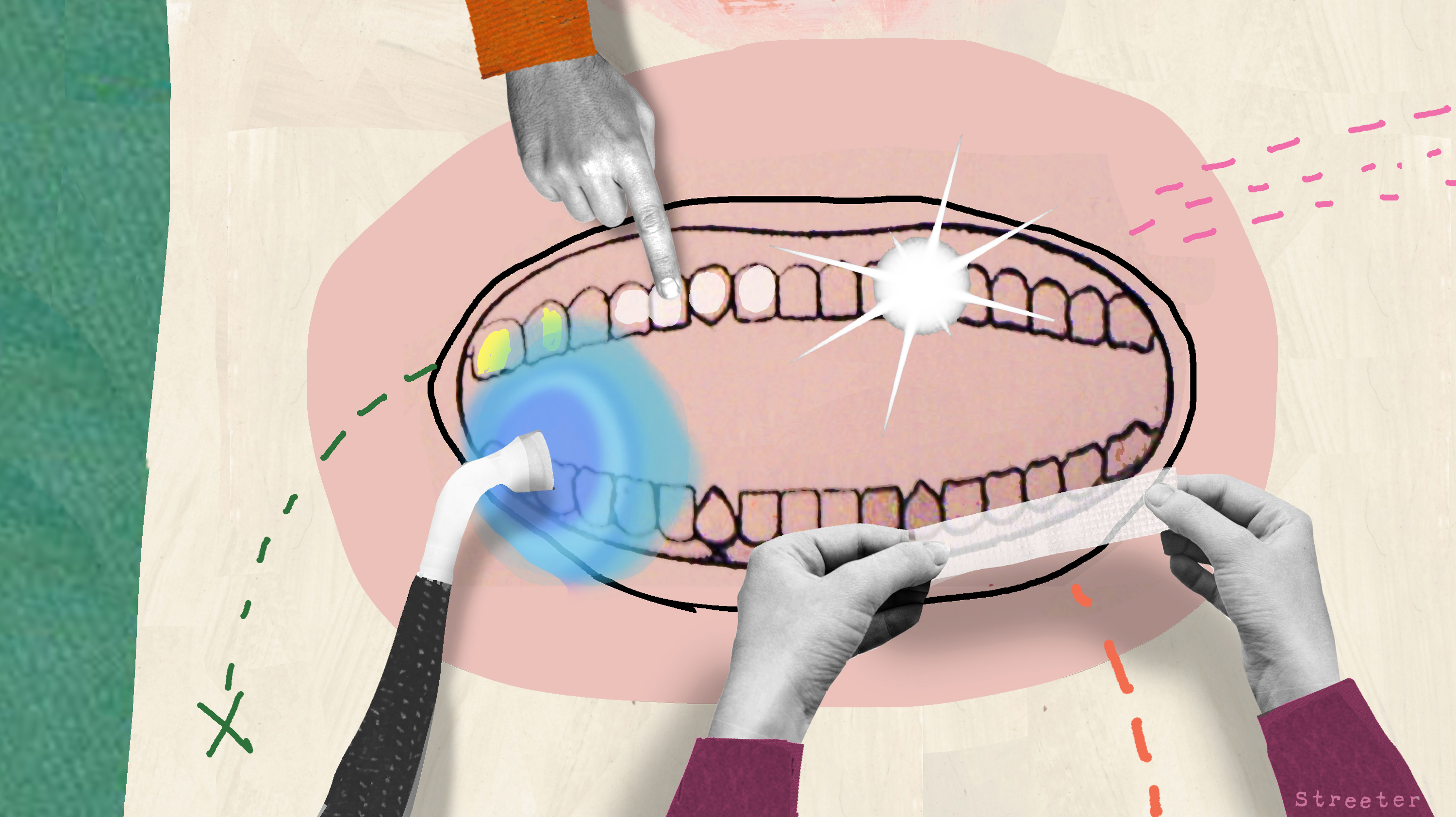Navigating The 'Aisle Of Confusion' To Whiten Your Teeth | NPR ...