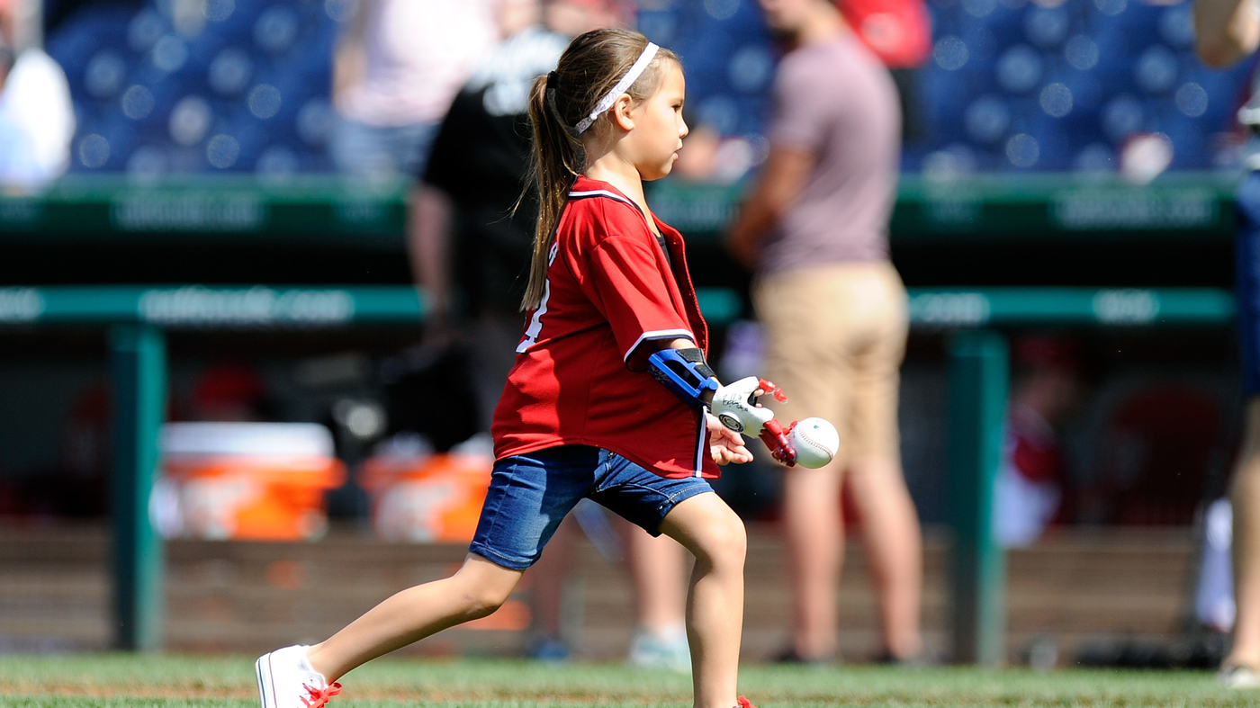 Using A Robotic Hand, She Wants To Throw Out The First Pitch For All 30 ...