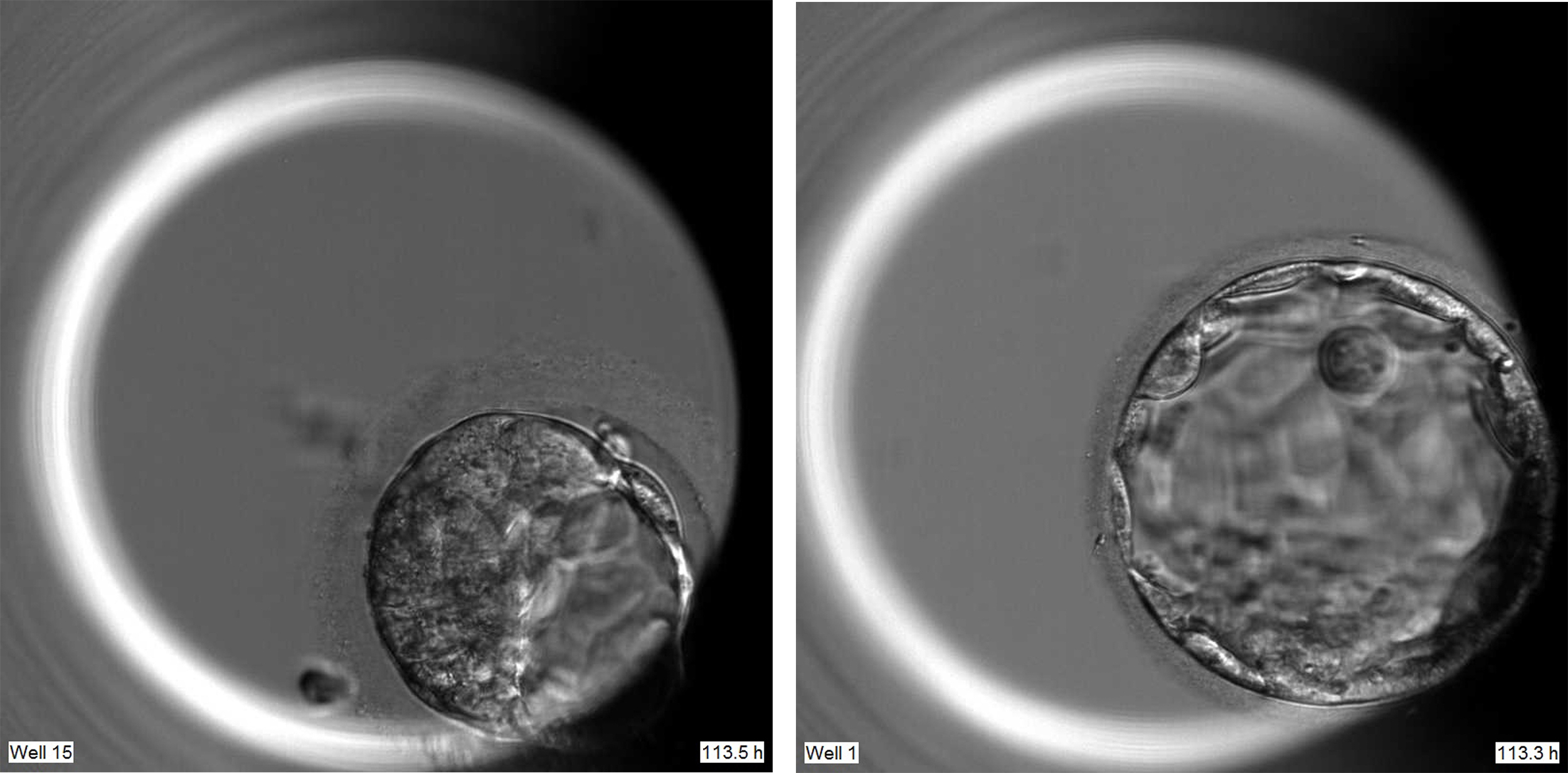 Editing Embryo DNA Yields Clues About Early Human Development | NCPR News