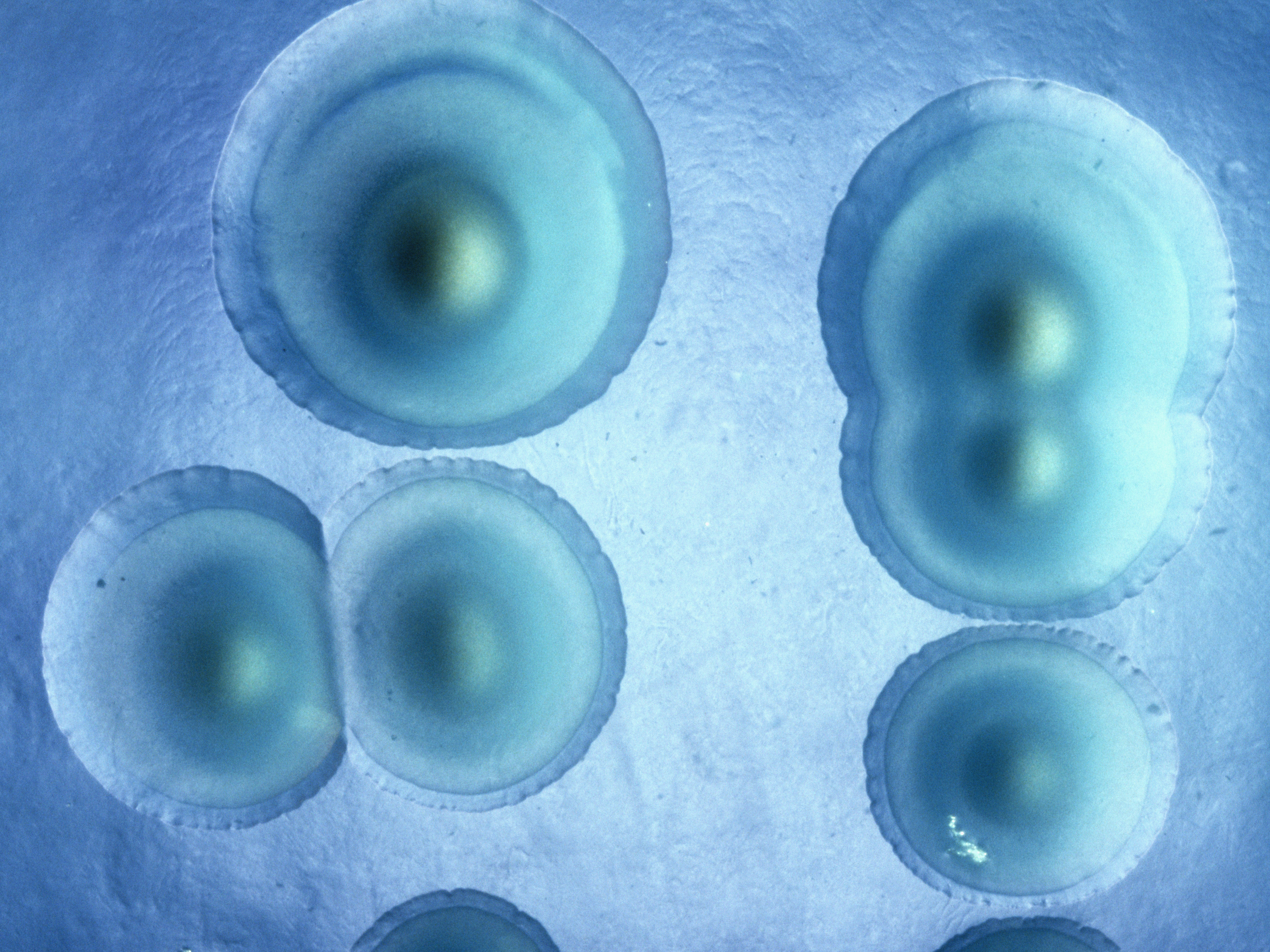 Drink Up! Volunteers Swallow Bacteria That Causes Typhoid | WBUR News