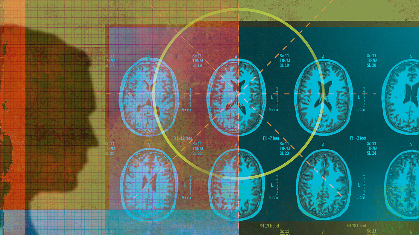 What Does A Normal Brain Look Like? : Shots - Health News : NPR