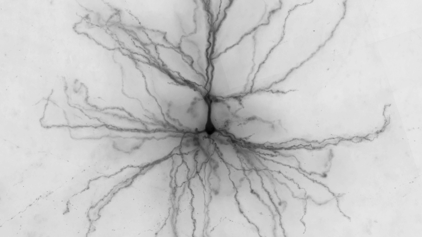 Scientists And Surgeons Team Up To Create Virtual Human Brain Cells ...