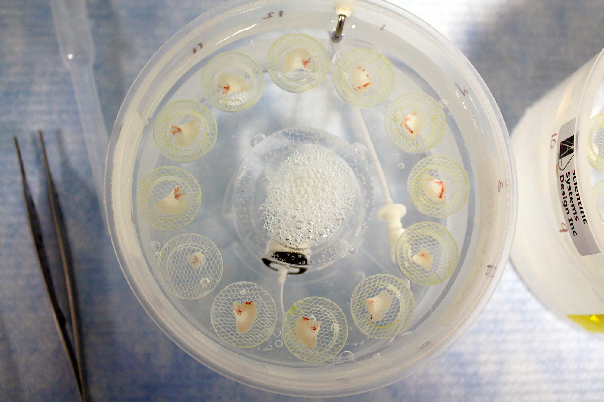 Scientists And Surgeons Team Up To Create Virtual Human Brain Cells ...