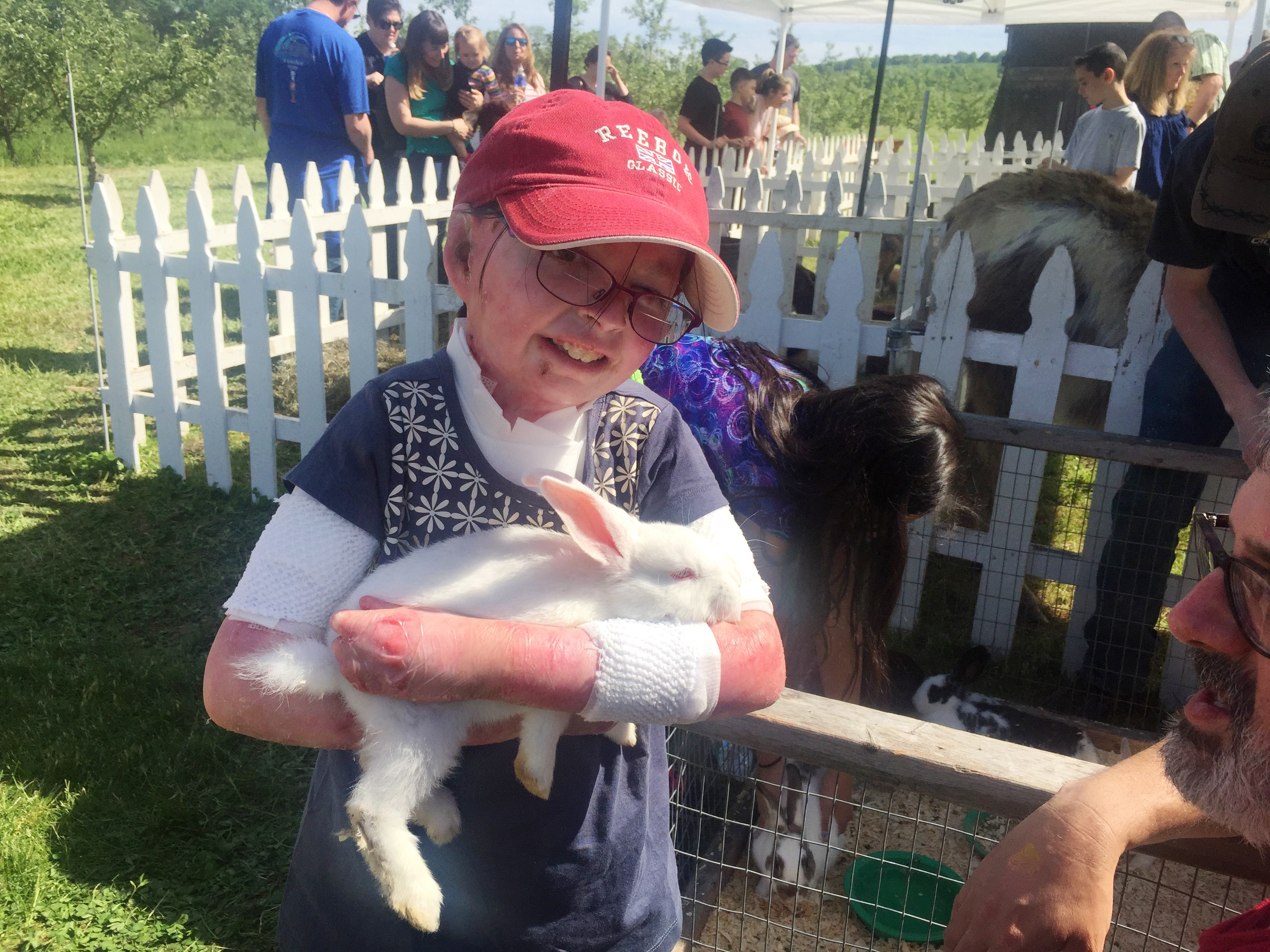 Genetically Altered Skin Saves A Boy Dying Of A Rare Disease | NCPR News