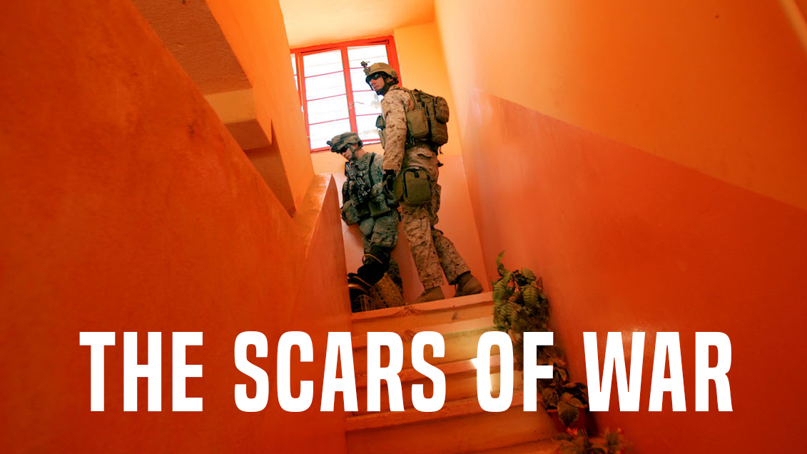 The Scars of War : Latino USA : NPR