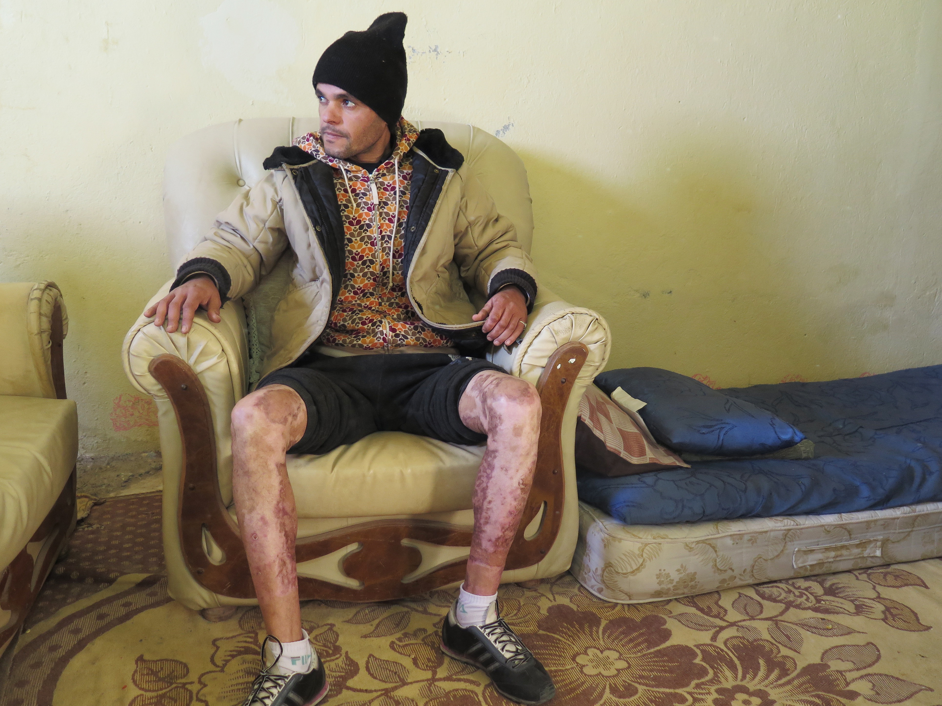 Self-Immolation Rises As Desperate Tunisians Seek Escape From Poverty ...