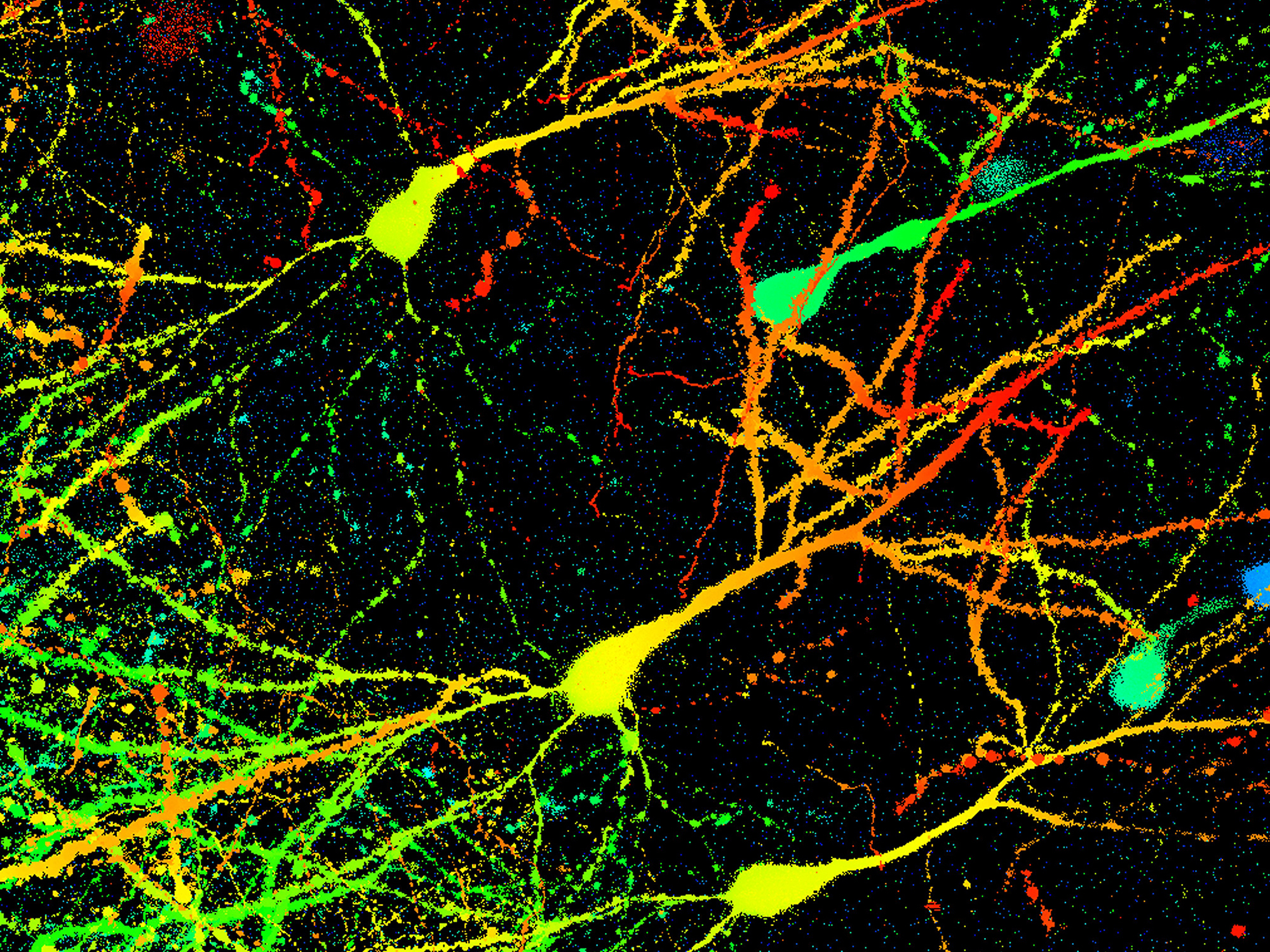 Researchers Discover 'Anxiety Cells' In The Brain | NCPR News