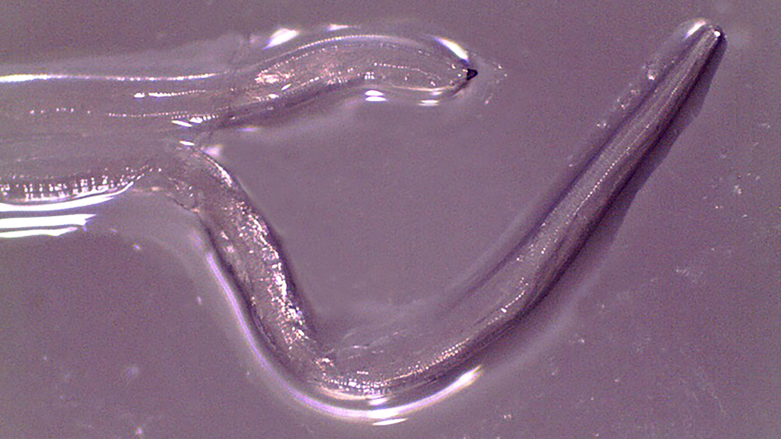 With 14 Worms In Her Eye, Abby Beckley Makes Medical History : Goats ...