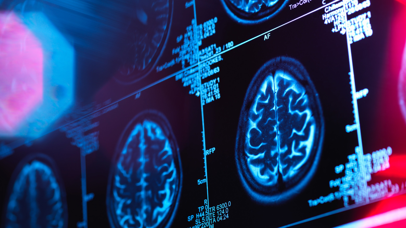 Harvard Brain Collection Will Help Scientists Dive Inside Eating ...