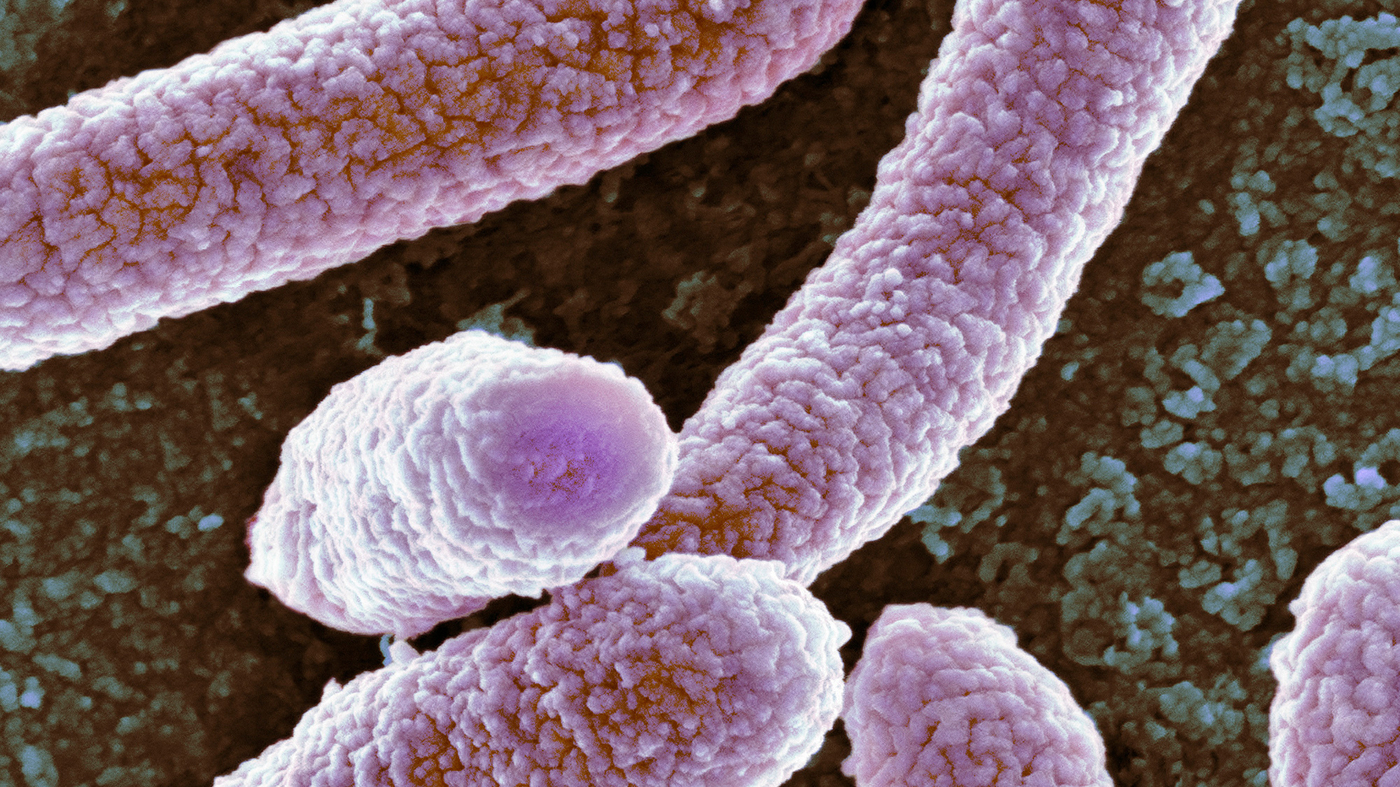 CDC Reports Efforts To Track 'Nightmare Bacteria' Is Turning Up : Shots ...