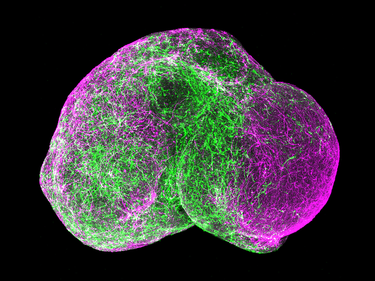Tiny Lab-Grown 'Brains' Raise Big Ethical Questions | NPR & Houston ...