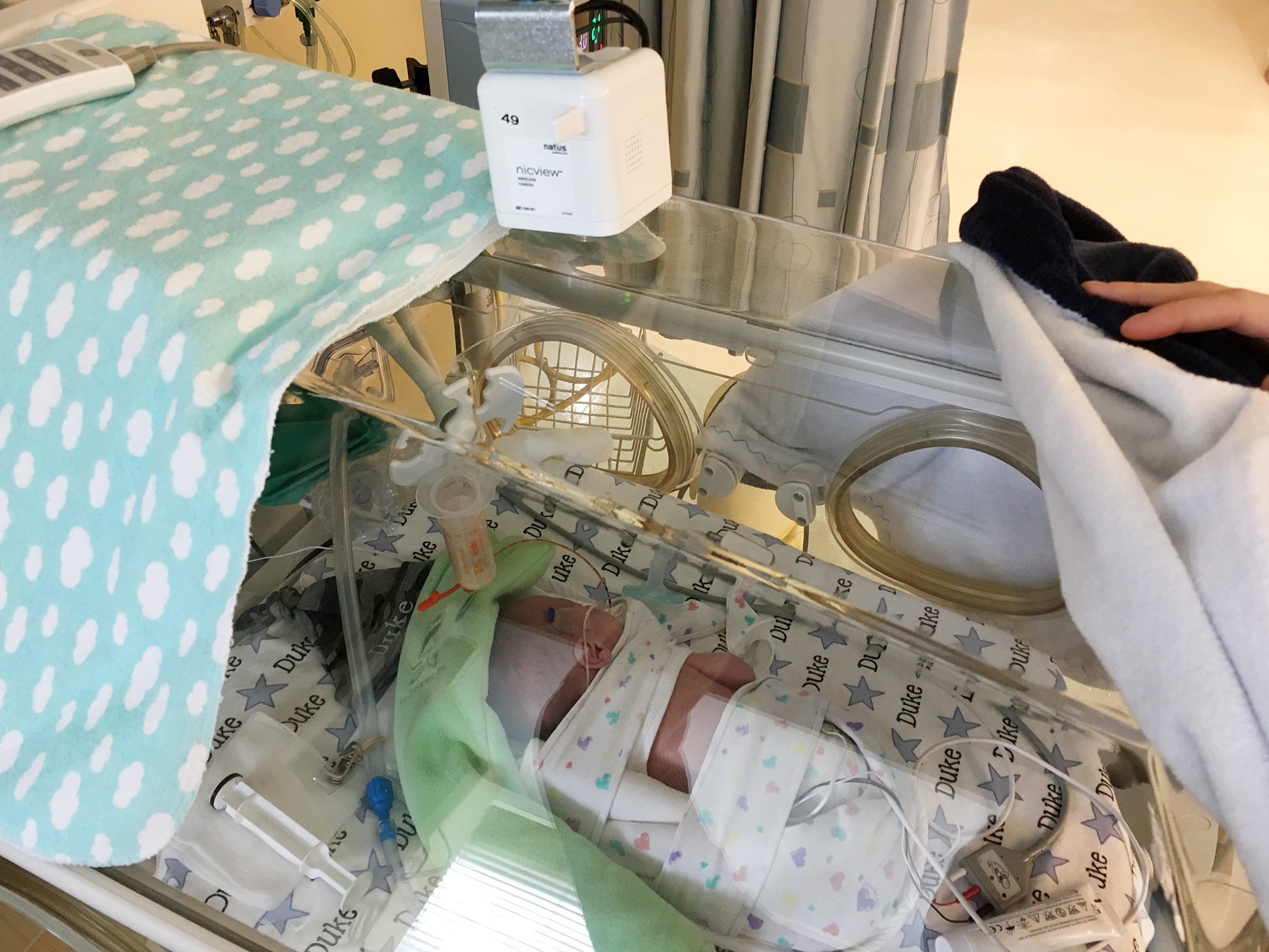 Cameras On Preemies Let In Families, Keep Germs Out | NCPR News