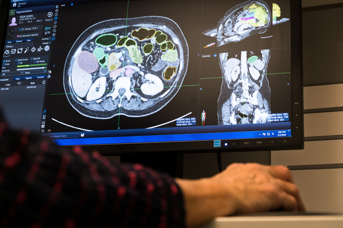 Can Artificial Intelligence Diagnose Cancer? : Shots - Health News : NPR