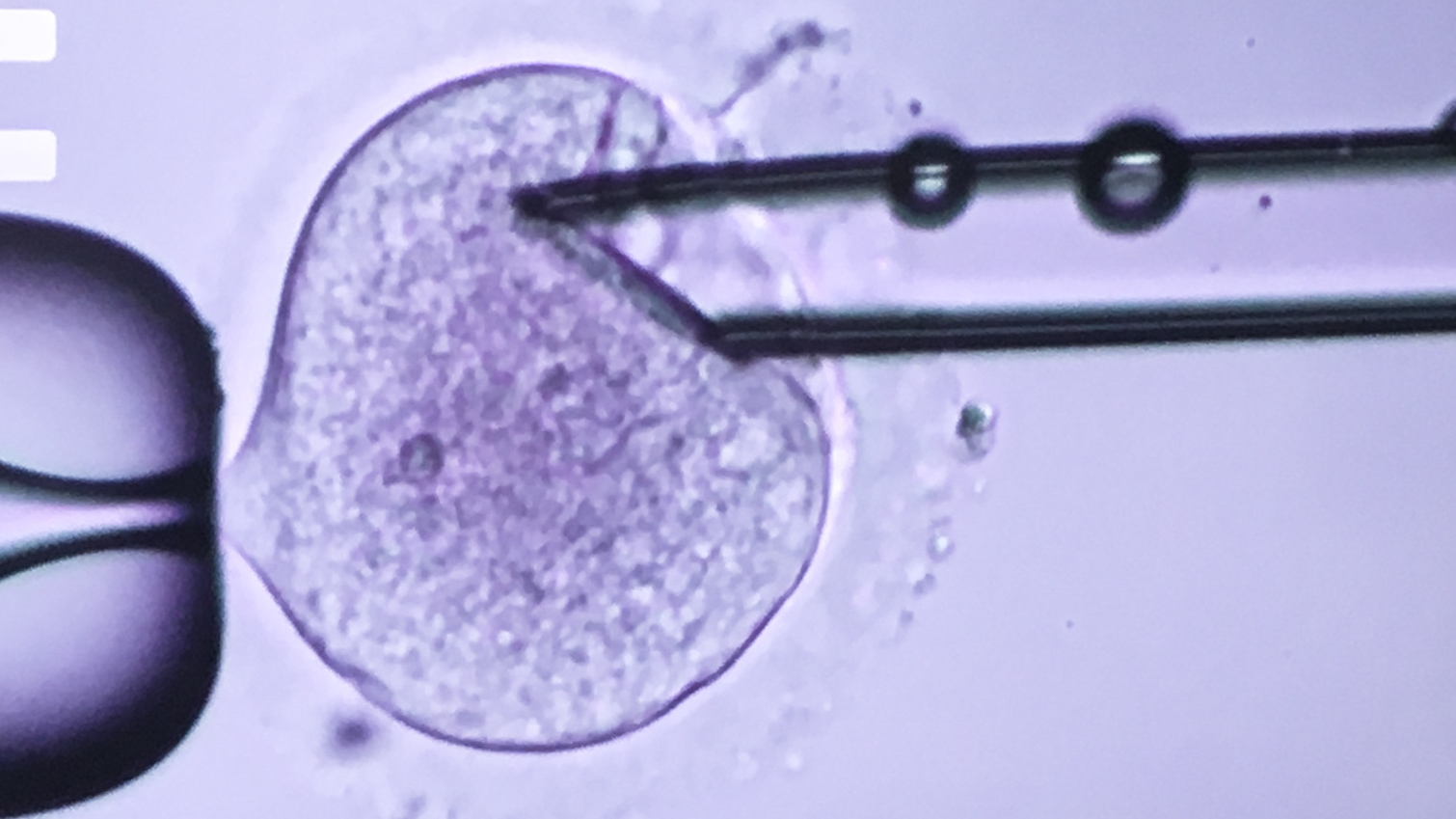Clinic Claims Success In Making Babies With 3 Parents' DNA | NPR ...