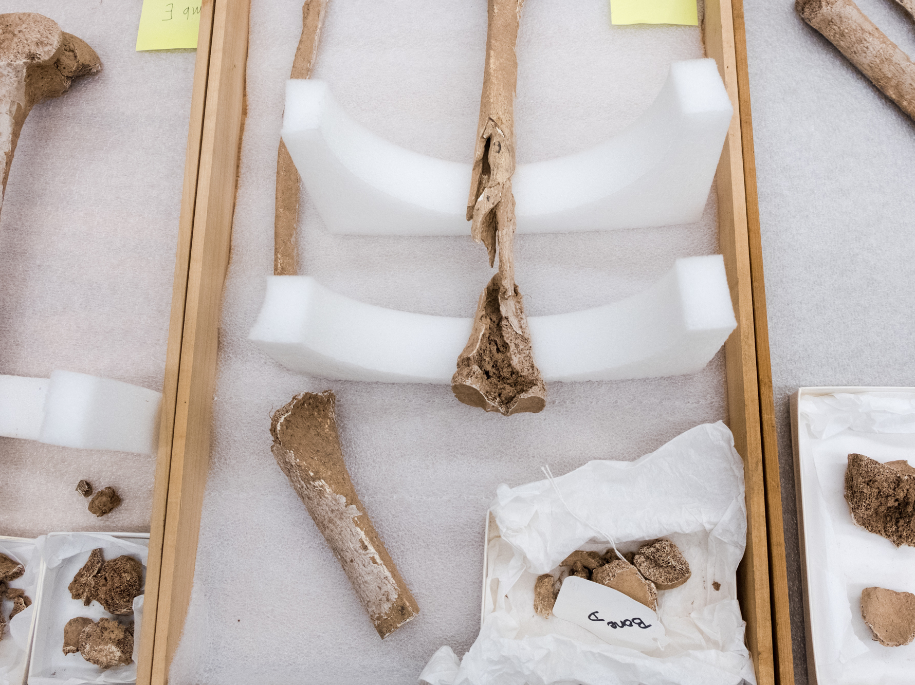 Civil War Battlefield 'Limb Pit' Reveals Work Of Combat Surgeons | NCPR ...