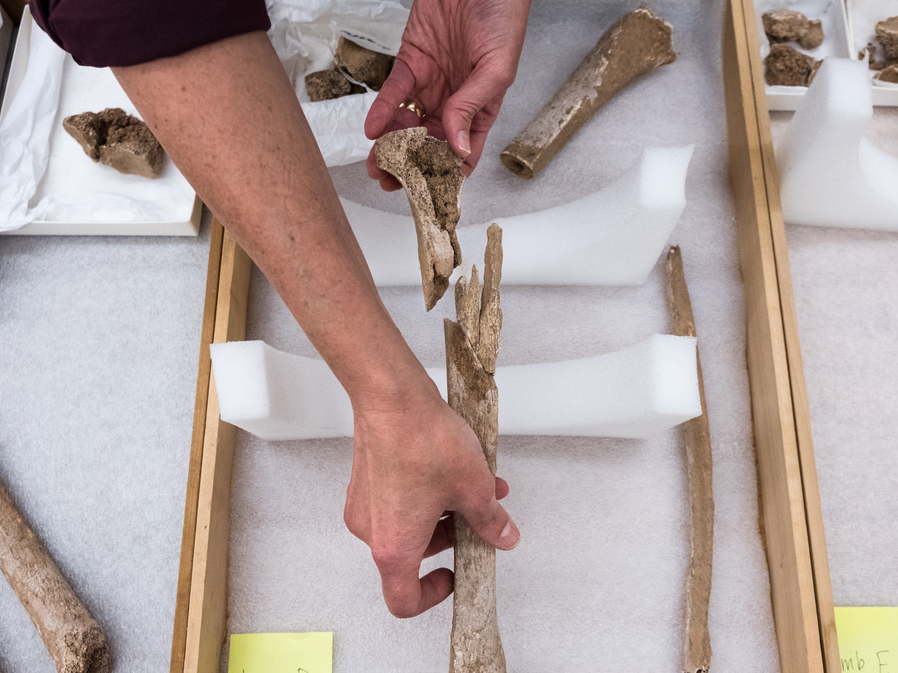 Civil War Battlefield 'Limb Pit' Reveals Work Of Combat Surgeons | NPR ...