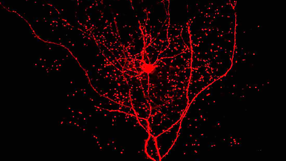 Newly Discovered 'Rose Hip' Neurons May Be Unique To Humans : Shots ...