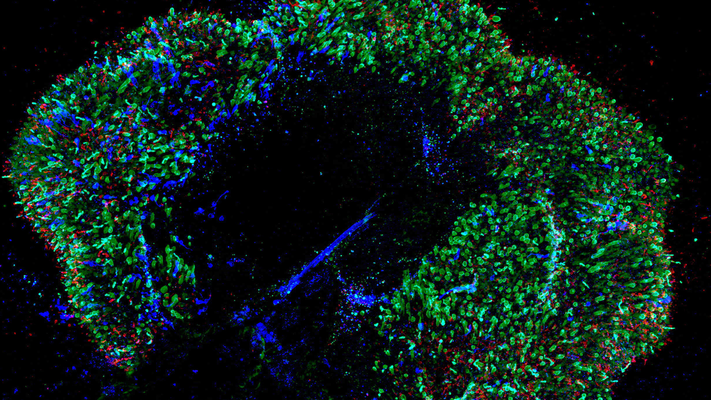 Secrets Of Color Vision Emerge From Lab-Grown Human Retinas : Shots ...