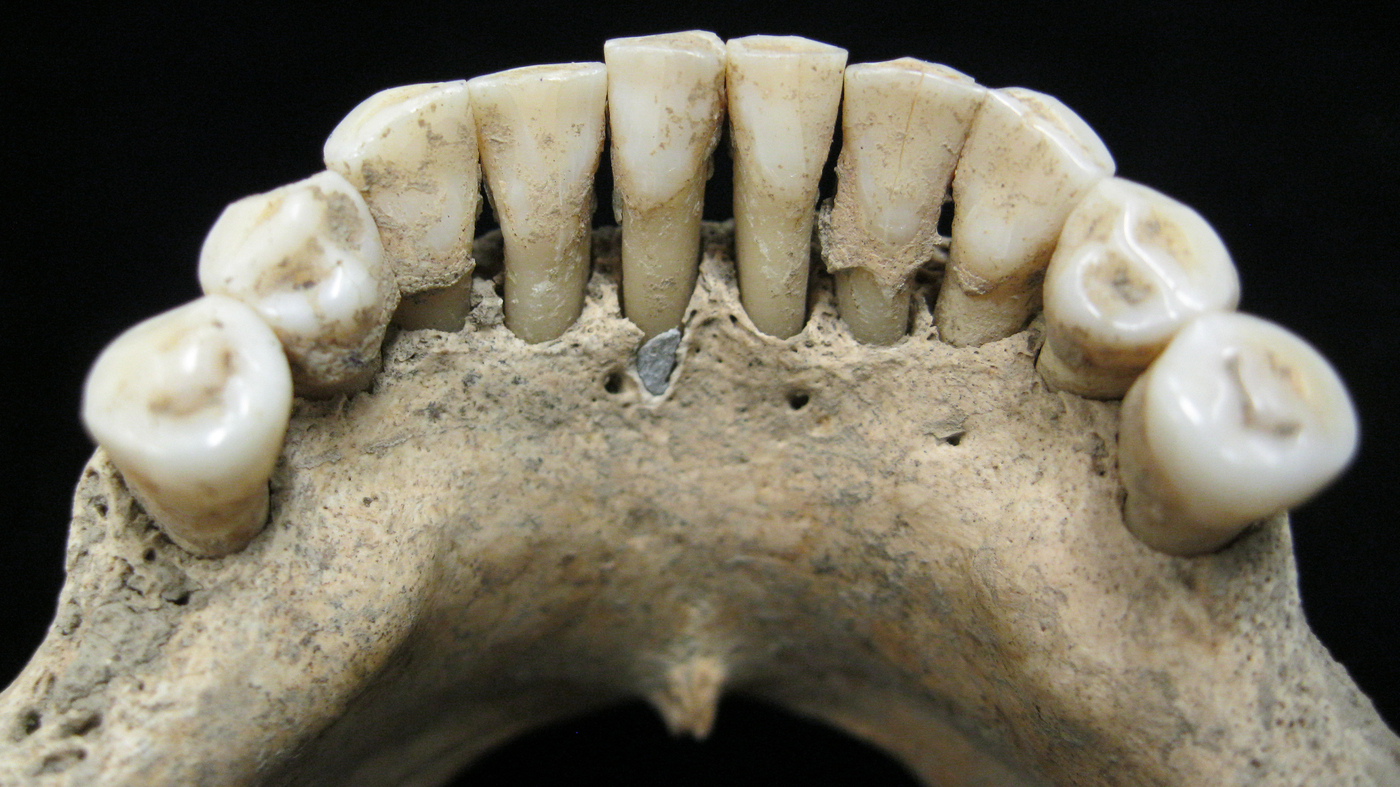 Blue Pigment In A Fossilized Tooth Traced To Medieval Woman's Work ...