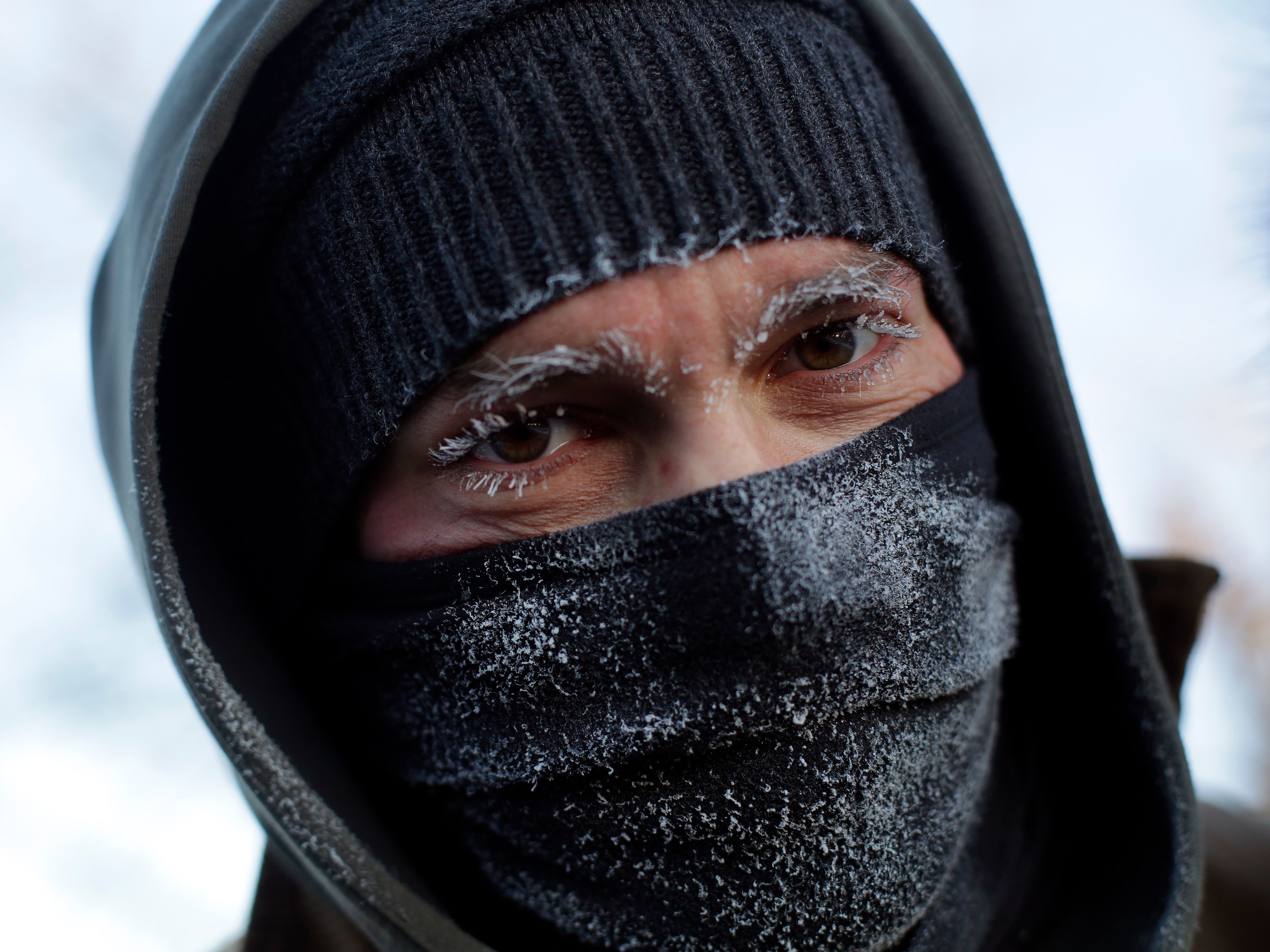 Medical Effects Of Extreme Cold: Why It Hurts And How To Stay Safe ...
