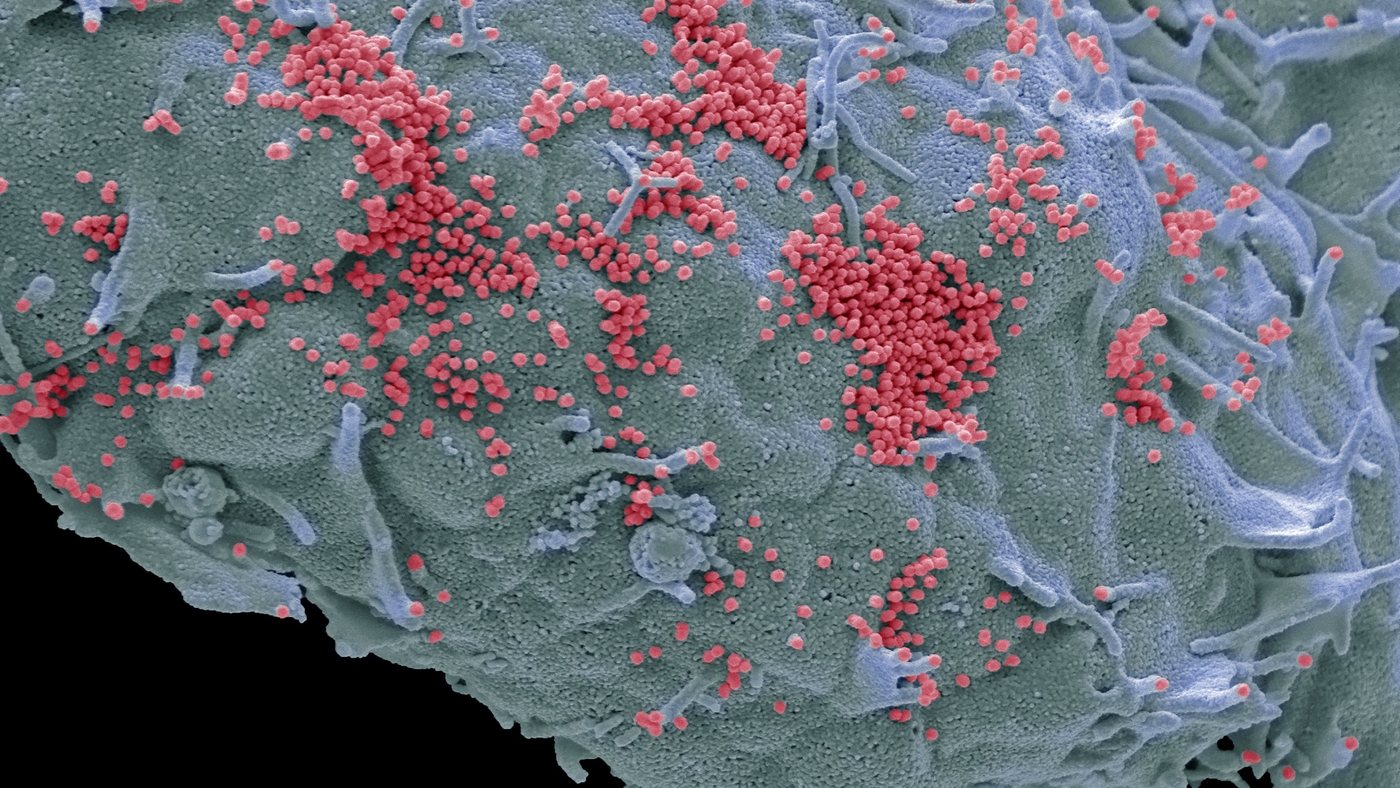 New Approach To Flu Treatment Mimics Antibodies : Shots - Health News : NPR