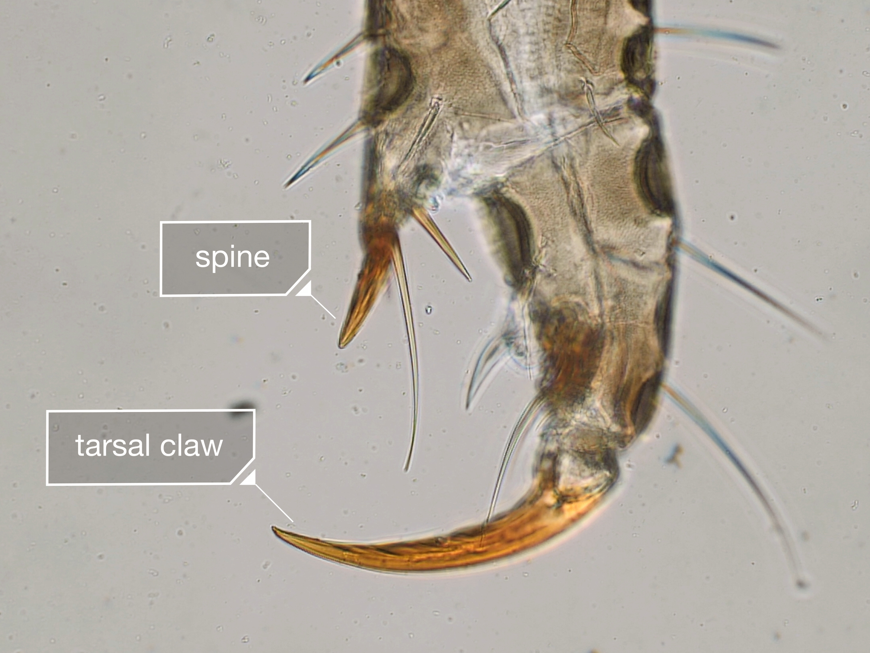 VIDEO: Head Lice Up Close, And All Too Personal | NCPR News