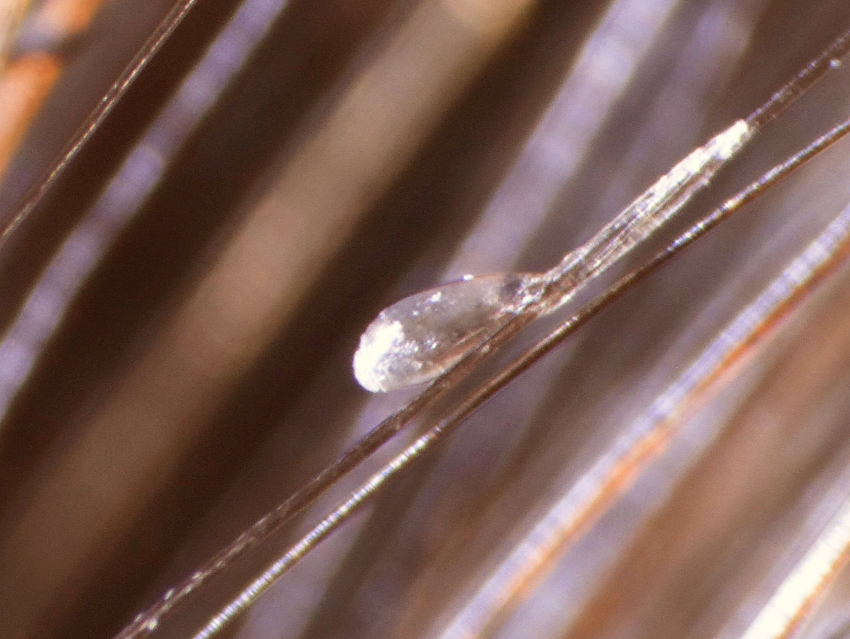 VIDEO: Head Lice Up Close, And All Too Personal | NCPR News