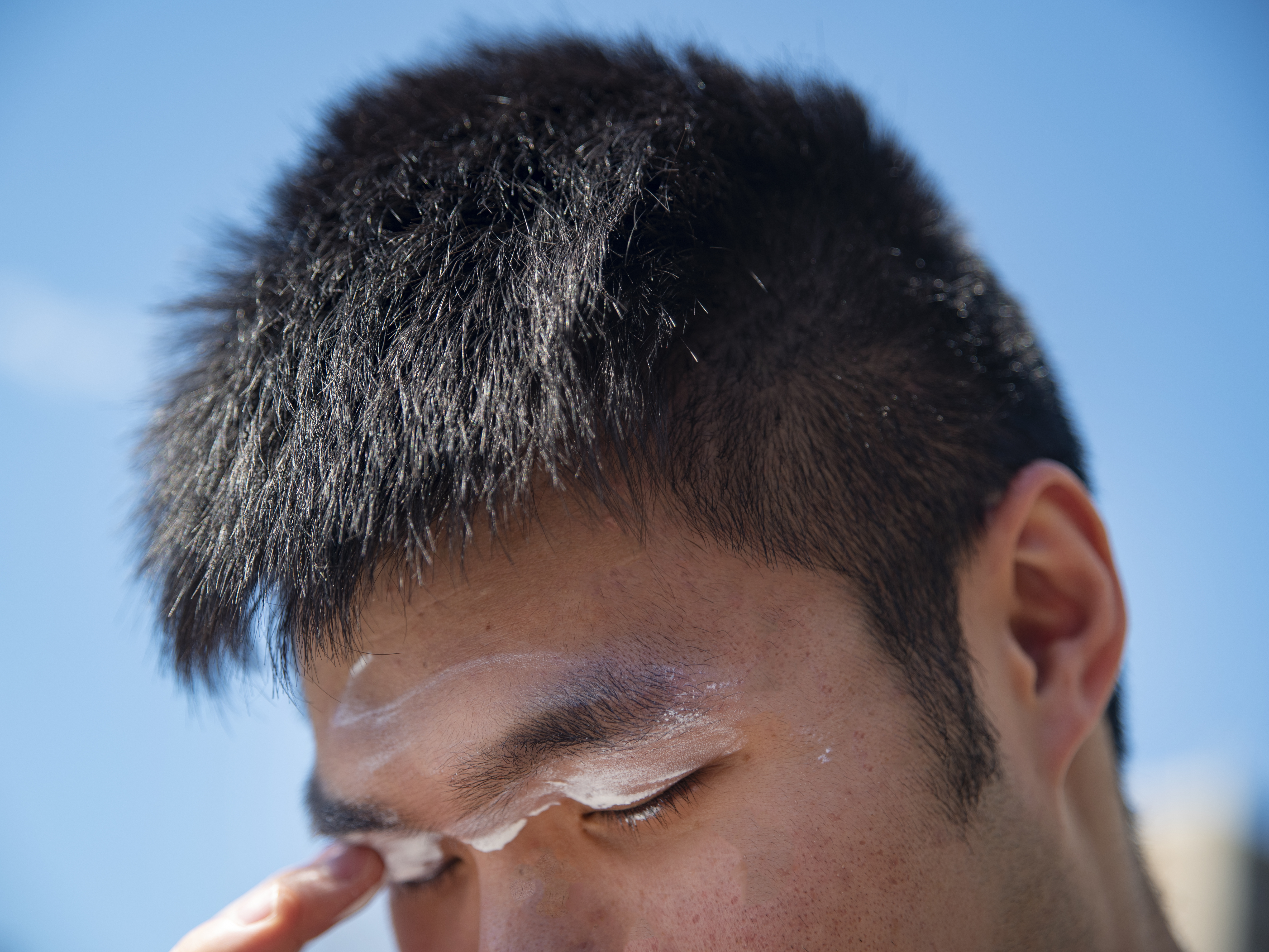 You Missed A Spot! Patchy Sunscreen Application Leaves Skin Vulnerable ...