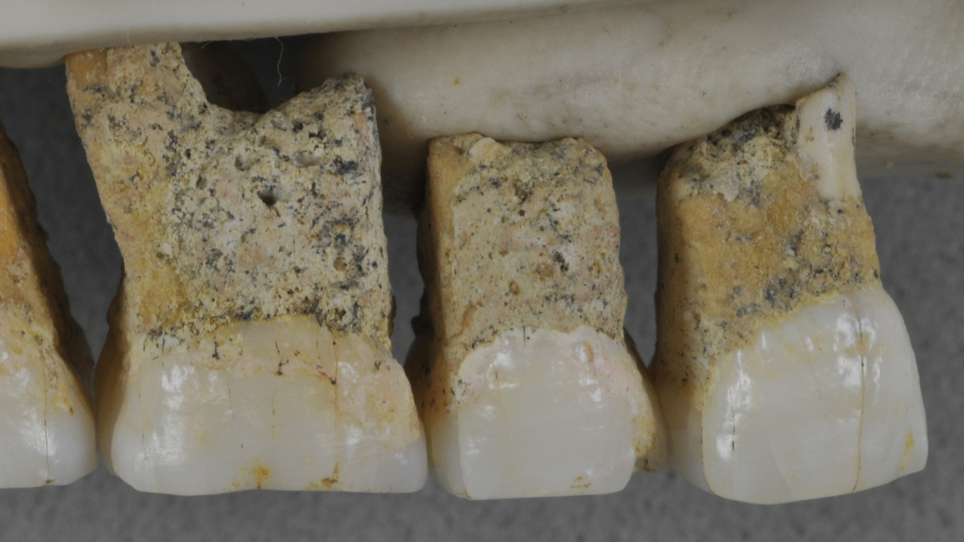 New Species Of Early Human Linked To Bones And Teeth In A Philippine ...