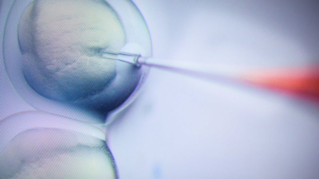 Russian Biologist Seeks To Edit Genes Of Human Embryos With CRISPR ...
