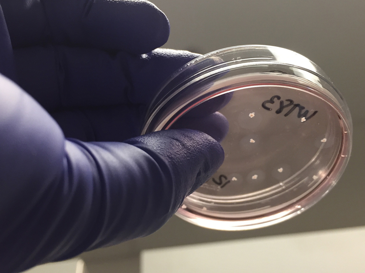 Lab-Grown 'Minibrains' Produce Brain Waves Spontaneously : Shots ...