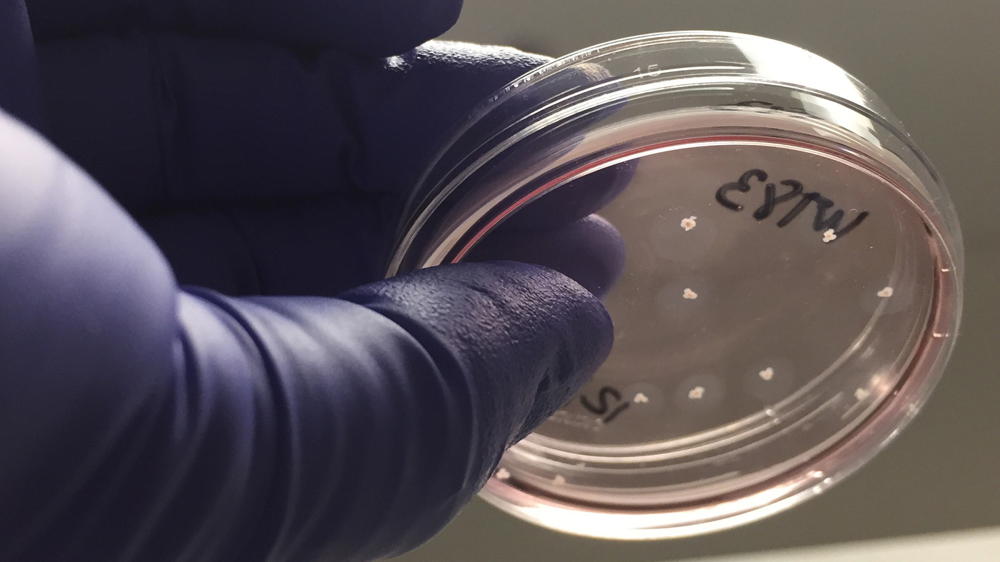 Lab-Grown 'Minibrains' Produce Brain Waves Spontaneously : Shots ...