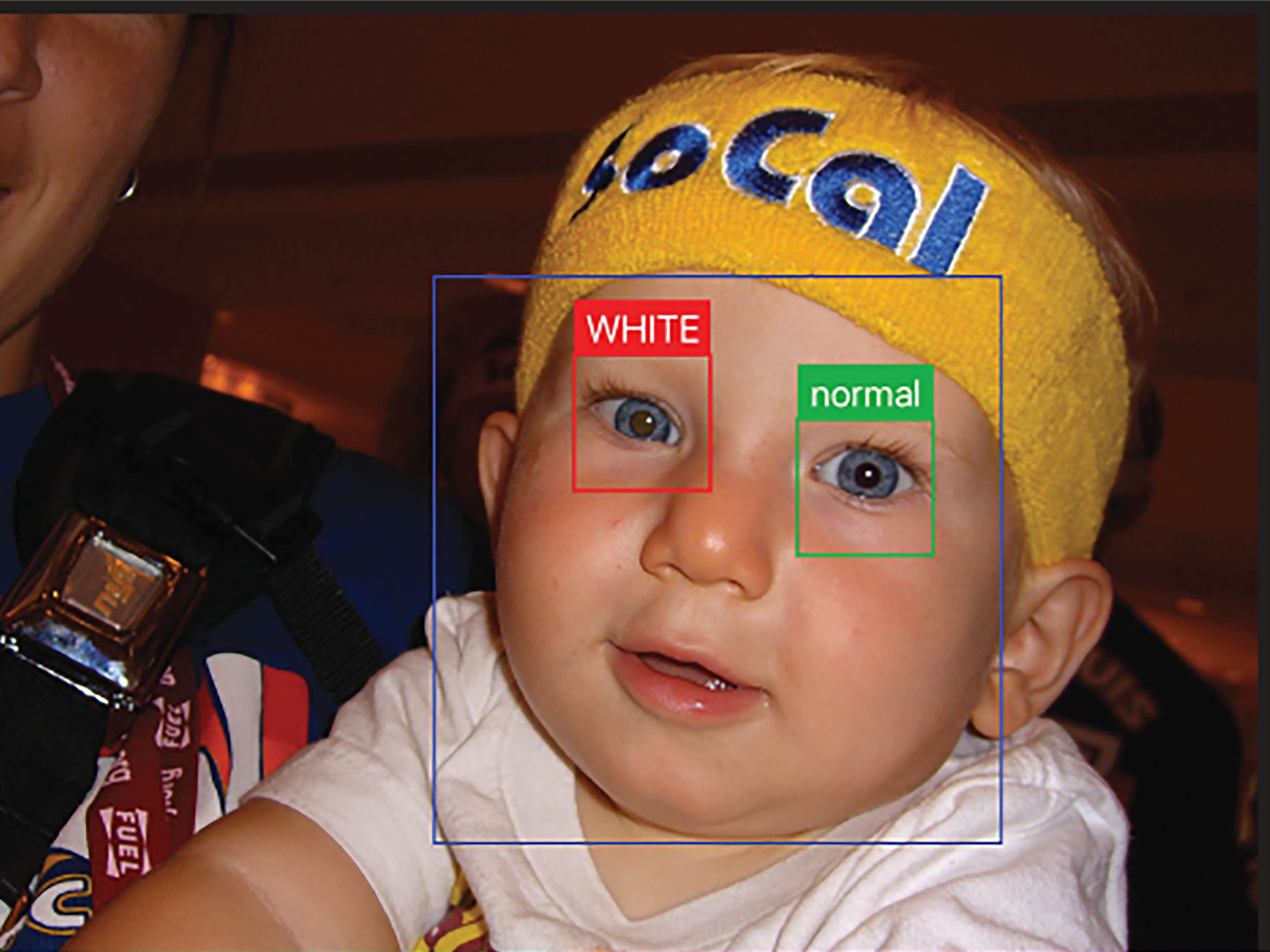 An App That Can Catch Early Signs Of Eye Disease In A Flash | NCPR News