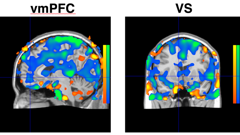 This Is Your Brain On Friendship : Invisibilia : NPR